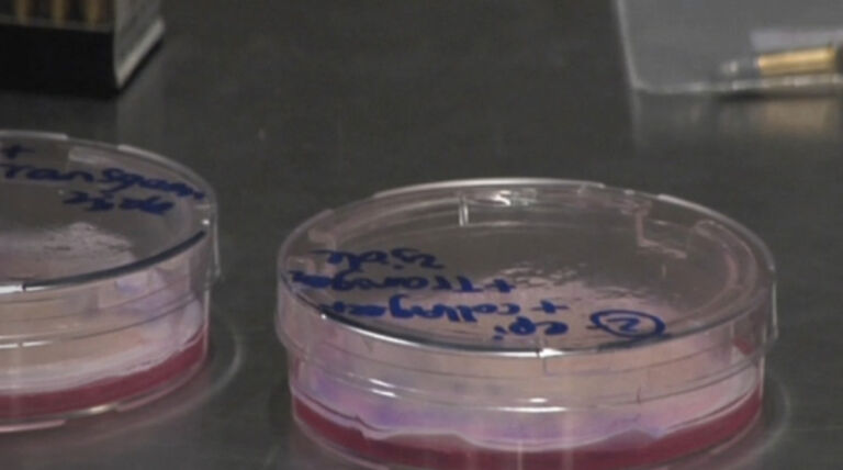 JALILA ESSAÏDI, spider silk & human tissue bulletproof skin